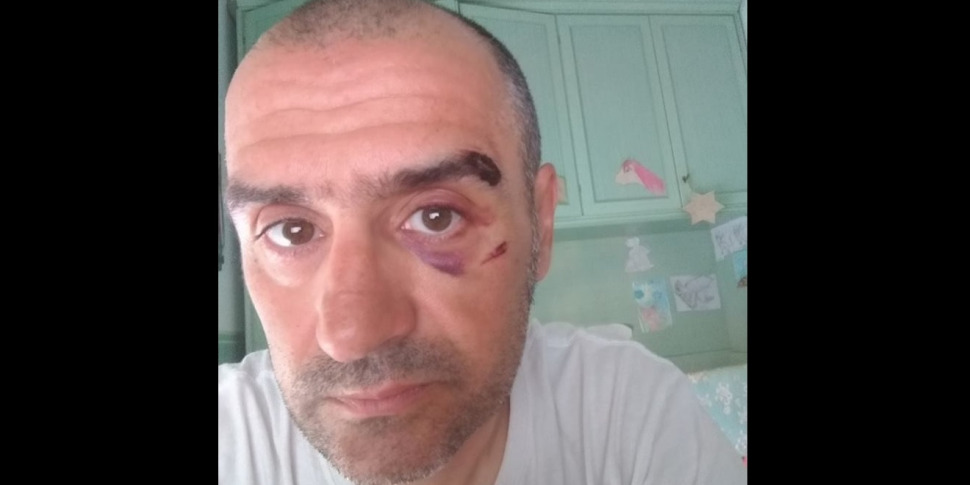 Aggressione a Paternò, automobilista colpisce un ciclista con un pugno ...